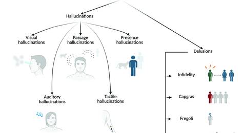 Meningeal Enhancement Seen on Workup for Memory Loss