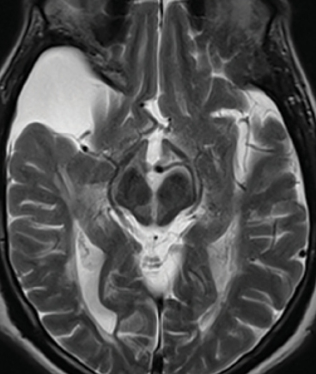 The Multiple Sclerosis Lesion Checklist