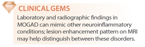 MOG Antibody Disease