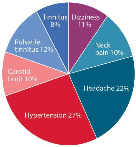 Fibromuscular Dysplasia and Stroke