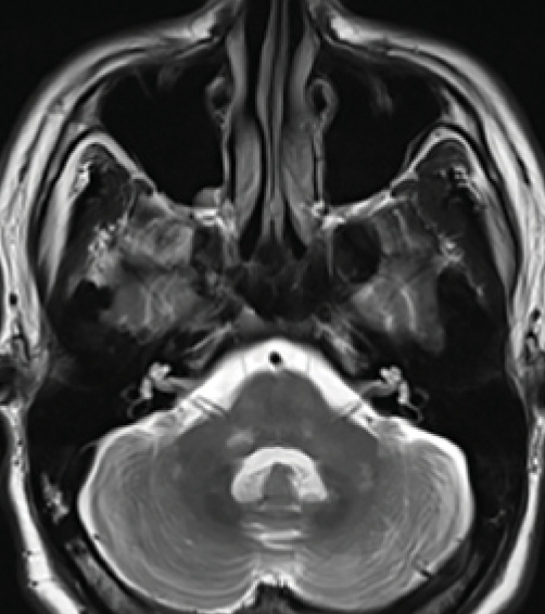 The Multiple Sclerosis Lesion Checklist