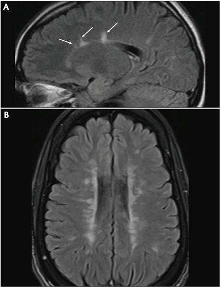 The Multiple Sclerosis Lesion Checklist