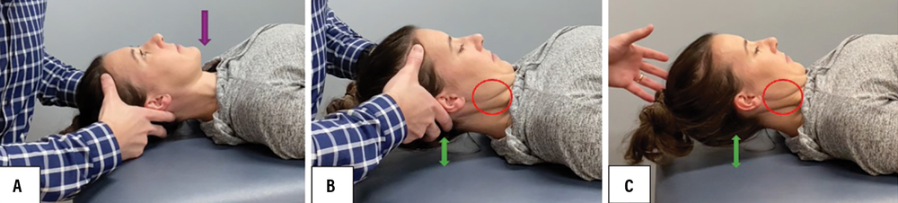 Cervical Spine Considerations in Headache Management