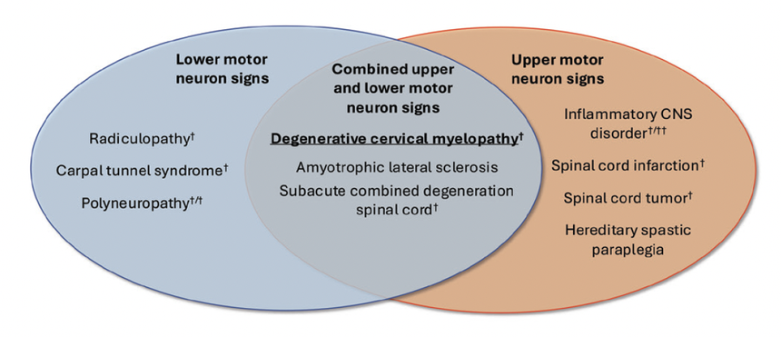 Degenerative Cervical Myelopathy as a Neuromuscular Mimicker