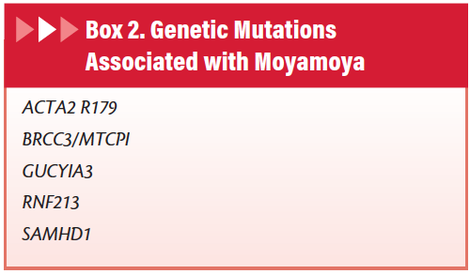 Moyamoya Disease