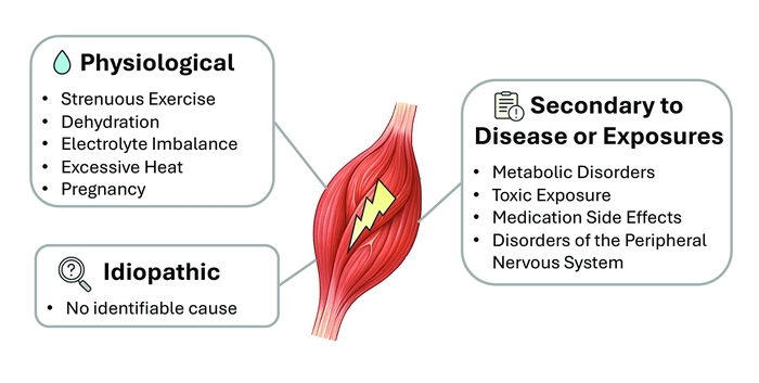 Diagnosis and Management of Muscle Cramps