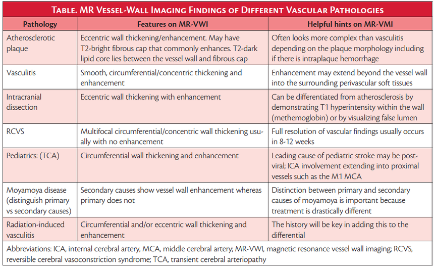 Stroke Snapshot: Intracranial MRI Vessel-Wall Imaging