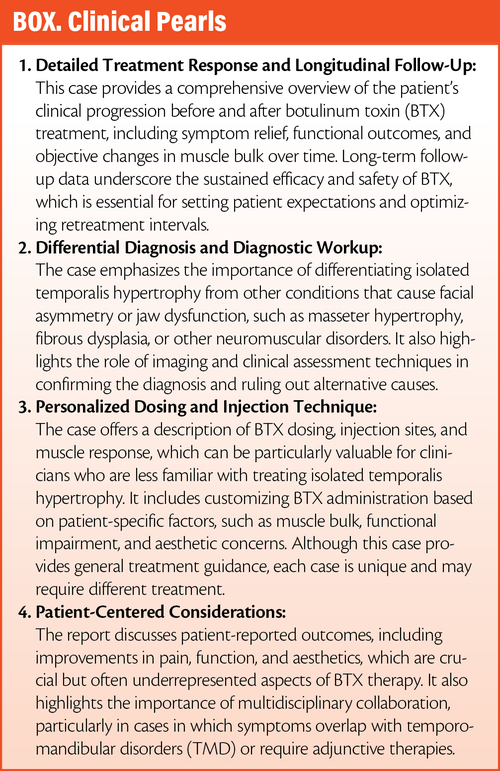 Bilateral Temporalis Muscle Hypertrophy with Headache, Pain