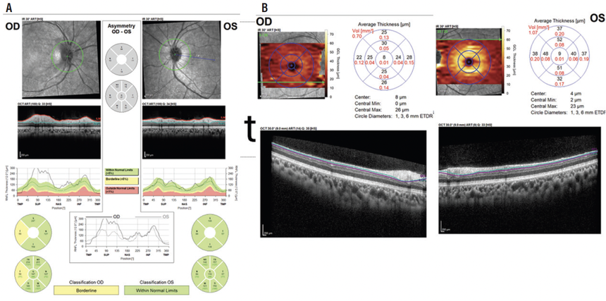 Neuro-Ophthalmology Notions: The Optic Nerve as Topographic
