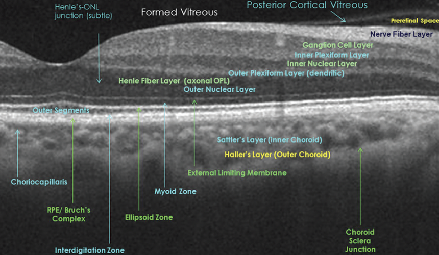 Optical Coherence Tomography & Neurology