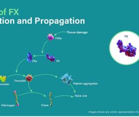 Stroke Snapshot: Metabolic Stroke