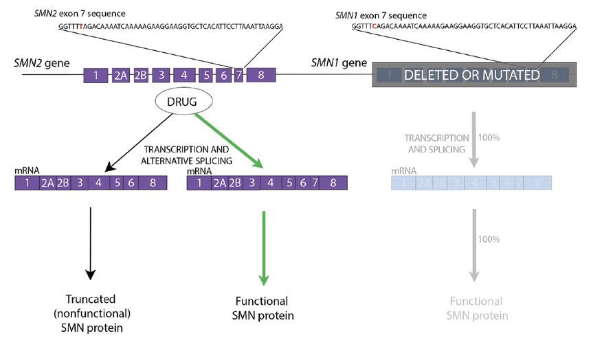 Spinal Muscular Atrophy is Now a Treatable Genetic Condition