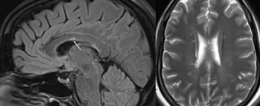 The Multiple Sclerosis Lesion Checklist