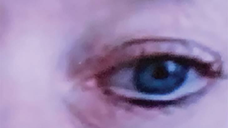 Teleneuro-ophthalmology