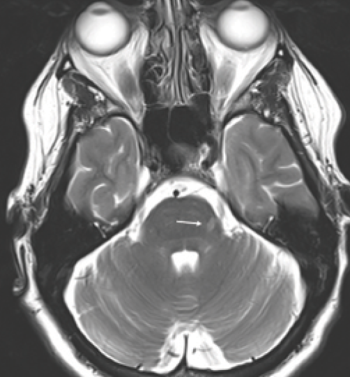 The Multiple Sclerosis Lesion Checklist