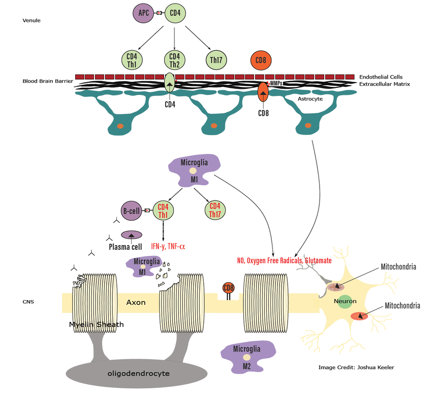 Immunopathogenesis of Multiple Sclerosis