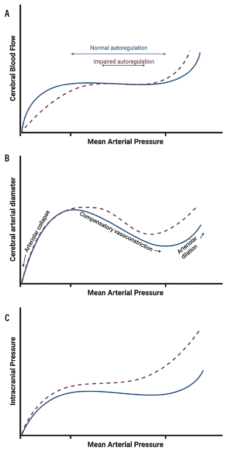 ICU Care for Severe Traumatic Brain Injury