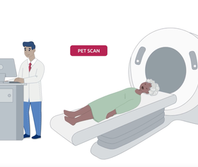 Meningeal Enhancement Seen on Workup for Memory Loss