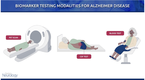 Selection and Interpretation of Biomarker Tests for AD