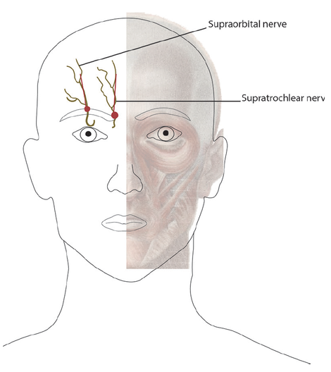Procedural Treatments for Headache Disorders