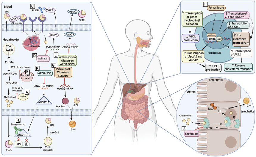 Novel Lipid-Lowering Agents and Stroke Prevention:New Tools,