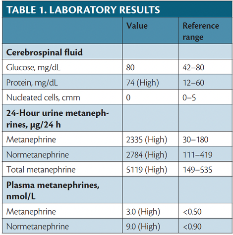 Cerebral Vasoconstriction and Vasospastic Angina Secondary t