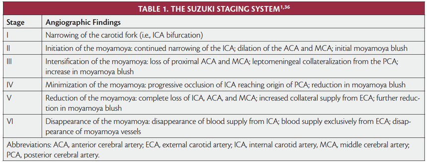 Moyamoya: An Update for the Practicing Neurologist