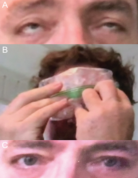 Teleneuro-ophthalmology