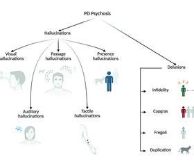 Meningeal Enhancement Seen on Workup for Memory Loss