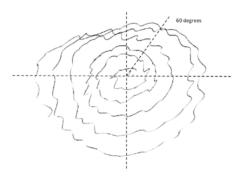 Evaluation of Patients With Tremor