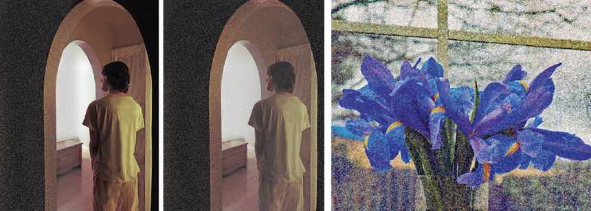 Migraine Visual Aura & Other Visual Phenomena