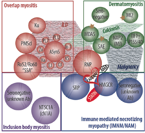 Inflammatory Myopathies