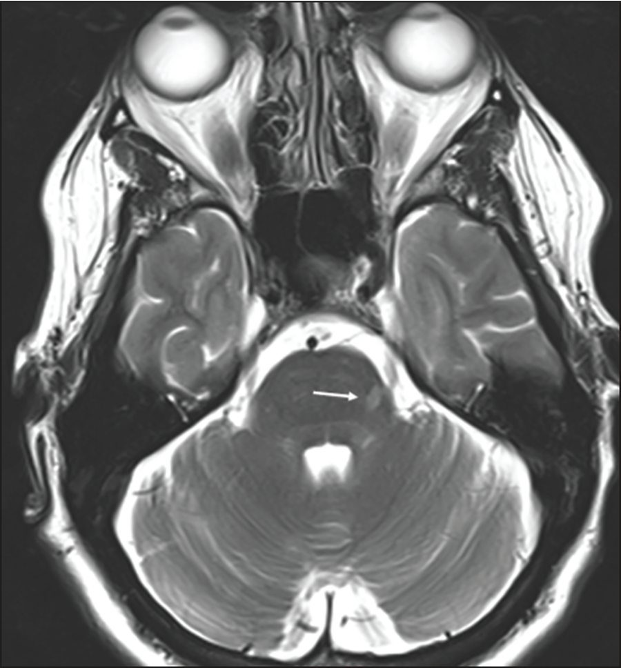 The Multiple Sclerosis Lesion Checklist