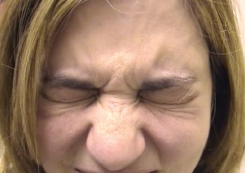 A Woman with Muscle Stiffness