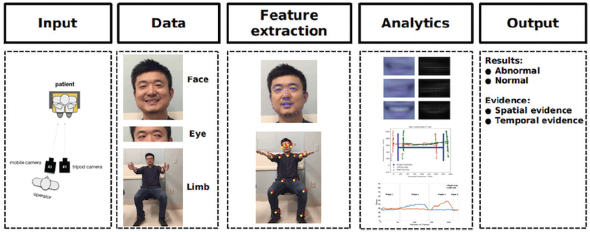 Stroke Snapshot: Incorporating Artificial Intelligence in St