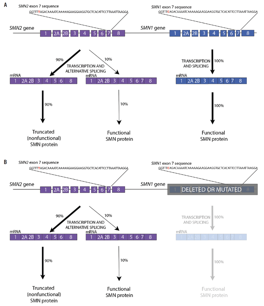 Spinal Muscular Atrophy is Now a Treatable Genetic Condition