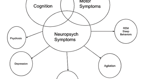Meningeal Enhancement Seen on Workup for Memory Loss