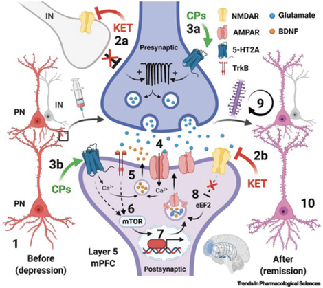 Headache Horizons: Emerging Use of Ketamine for the Treatmen