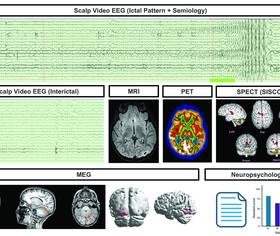 The New CPT Codes for Video-EEG