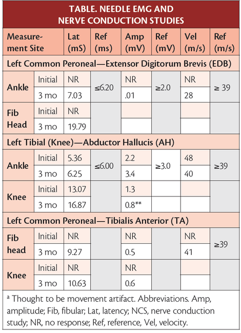 Peripheral Neuropathy Caused by Vitamin B12 Deficiency