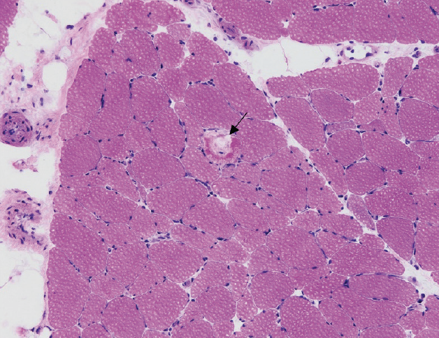 Challenge Case Report: Progressive Muscle Weakness