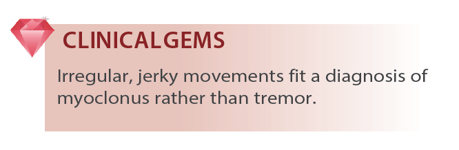 Video Case Report: Action Myoclonus After CAR-T Cell Therapy