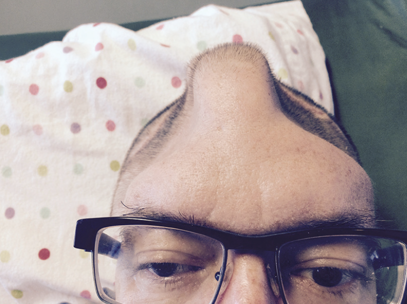 Inpatient Rehabilitation Following Traumatic Brain Injury