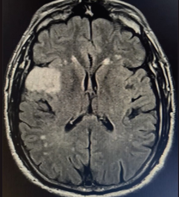 Case Conference: The “Noise” of Medicine