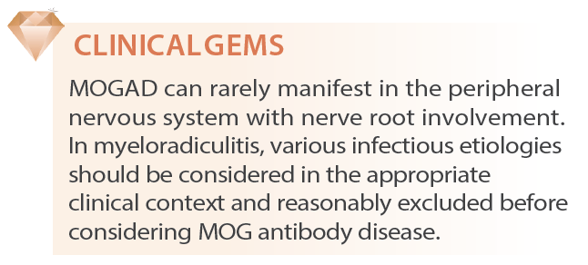 MOG Antibody Disease