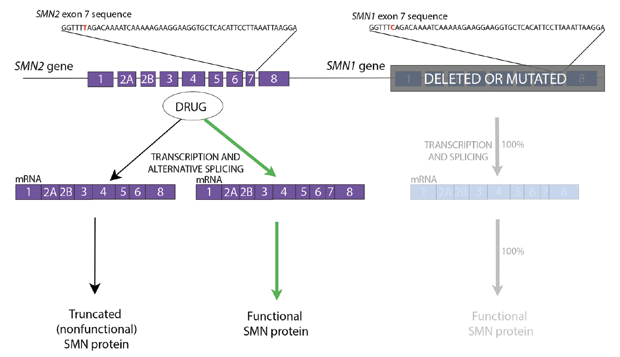 Spinal Muscular Atrophy is Now a Treatable Genetic Condition