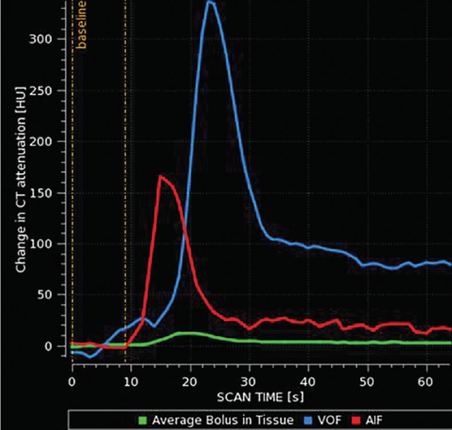 RAPID Automated CT Perfusion in Clinical Practice