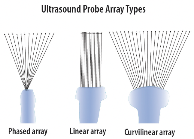 Point-of-Care Ultrasound for Outpatient Neurology