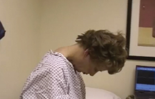 Dropped Head Syndrome