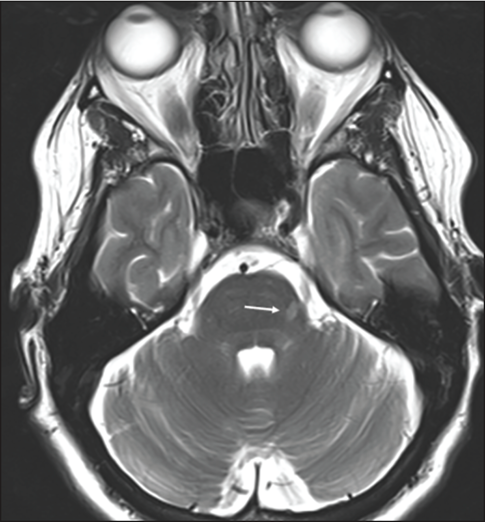 The Multiple Sclerosis Lesion Checklist
